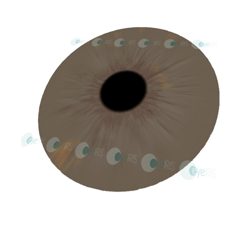 Prótesis ocular, ojos artificiales, iris oculares